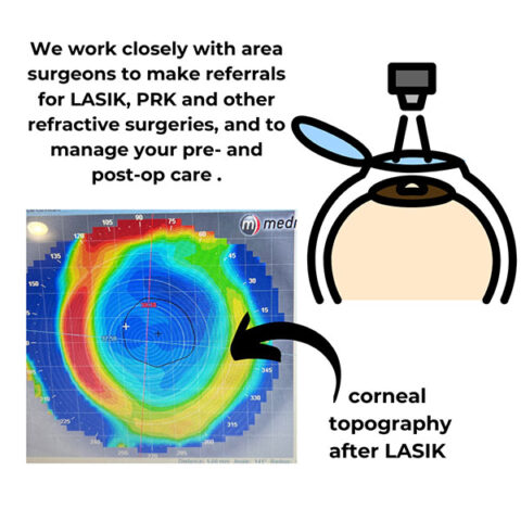 LASIK Consulting & Surgery Co-Management, Raleigh & Morrisville, NC