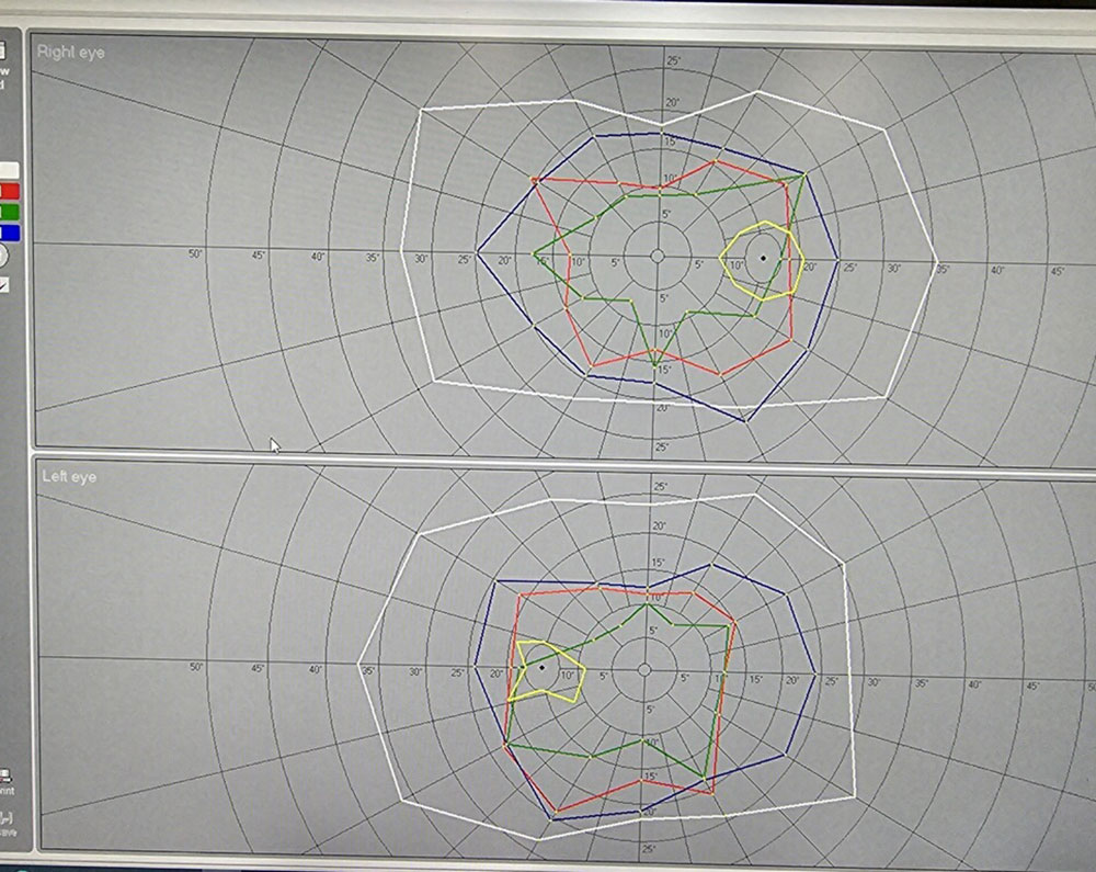 Syntonics in Raleigh